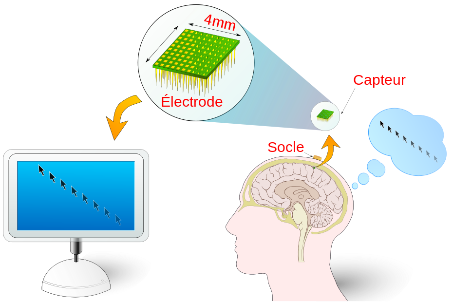 Interfaces cerveau-machine : un marché de plus de 200 millions de ...